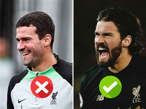 Alisson Divides Twitter With New Beardless Look ‘barber Needs To Have