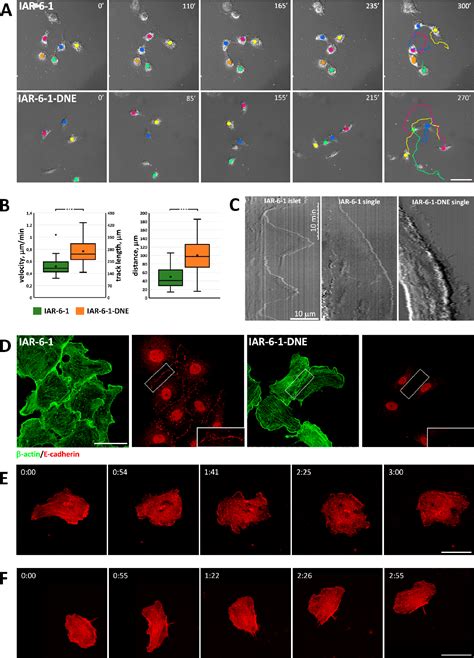 Figure 1 From Actin Cytoskeleton Remodeling Accompanied By