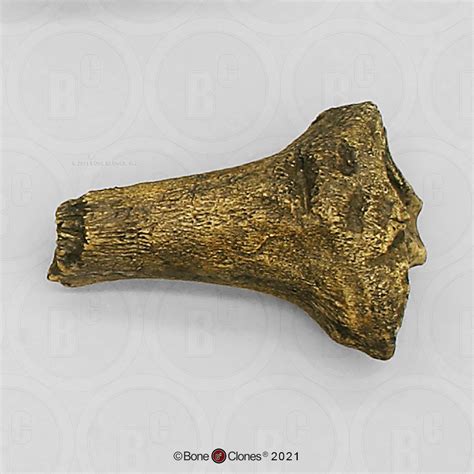 Australopithecus Anamensis Right Proximal Tibia Knm Kp 29285a Bone Clones Osteological