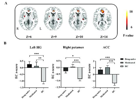 Differences In Effective Connectivity Ec From Brocas Area To Every Download Scientific