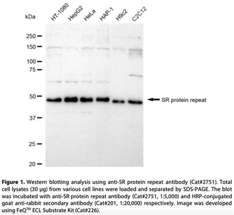 Anti SRSF6 Rabbit Monoclonal Ab 2751 GenuIN Biotech