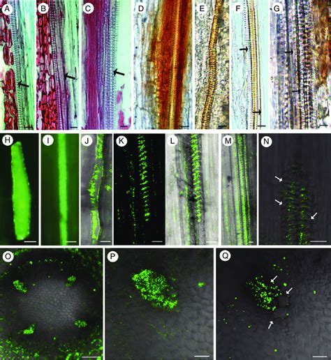 Pioneer Root Stele Comparative Anatomy Of Consecutive Root Segments