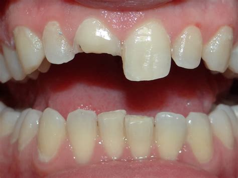 Бондинг Санитус Дент гр Пловдив