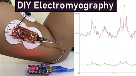 Electromyography With Myoware Muscle Sensor And Arduino