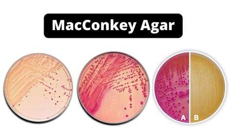 Macconkey Agar Composition Uses Colony Characteristics Biology Notes Online