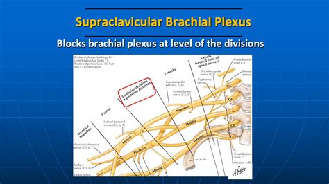 Learn How To Perform Ultrasound Guided Brachial Plexus Blocks Clarius