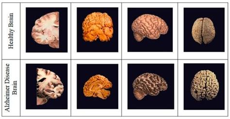 Prasanalakshmi B Smieee Fhea On Linkedin Hybridized Deep Learning Approach For Detecting