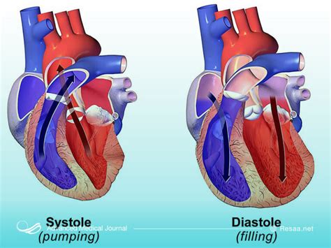 دلایل عمده ایست قلبی چیست؟ مجله پزشکی رسا