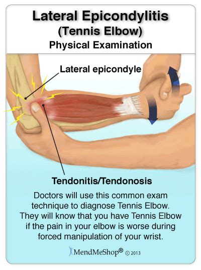 Tennis Elbow Test