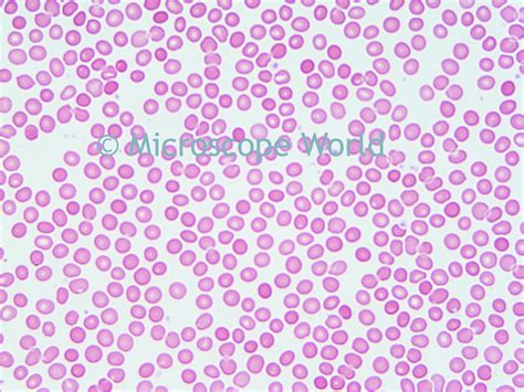 Microscope World Blog What Magnification Do I Need