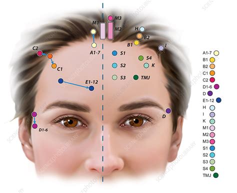Acupuncture Points Illustration Stock Image C0501370 Science Photo Library