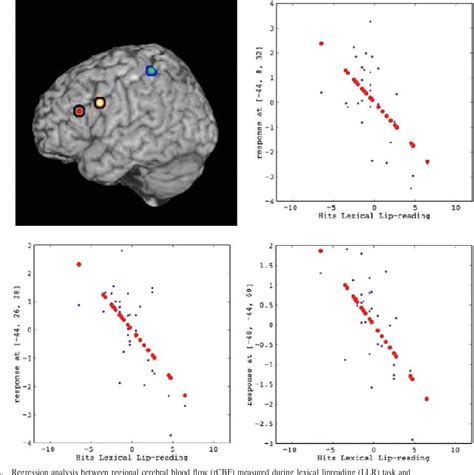 Figure 1 From A Functional Anatomical Model For Lipreading Semantic Scholar