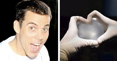 Jackass Star Steve O Just Revealed Hes Getting Implants For His Next Stunt