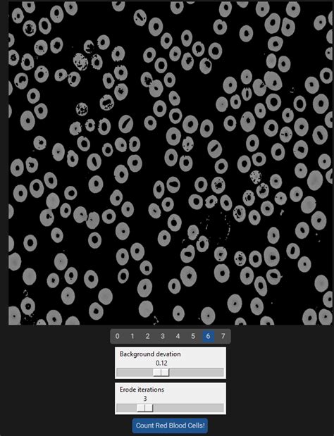 Github Sklimaszredbloodcells Analyzer App Easily Count Red Blood