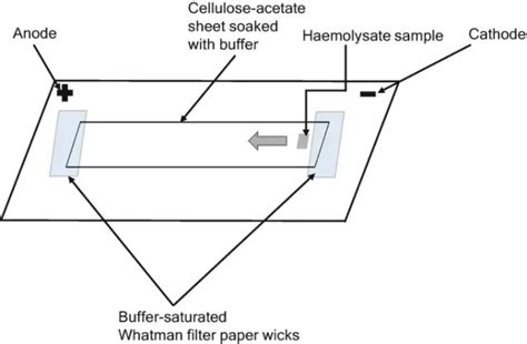 Cellulose Acetate Electrophoresis Principle And Application • Microbe