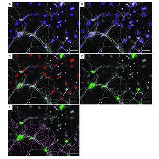 PDF High Content Analysis Of Hippocampal Neuron Astrocyte Co Cultures Shows A Positive Effect
