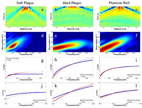 Sample Shear Wave Axial Displacement Colour Maps Showing The Shear Wave