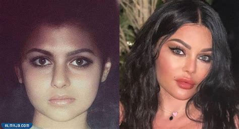 هيفاء وهبي قبل وبعد موقع المرجع