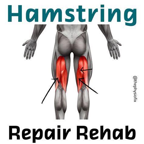 The Physio Fix Post Op Proximal Hamstring Repair Phase