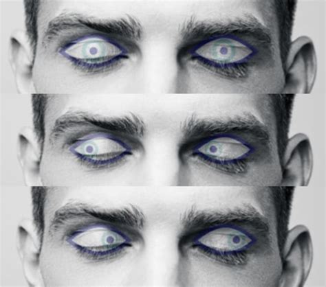 Rem Rapid Eye Movement At Dorla Walker Blog