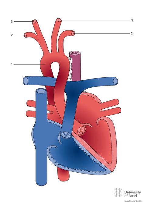 Right Aortic Arch Tiny Tickers