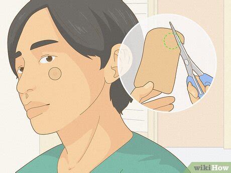 9 DIY Pimple Patch Treatments You Can Easily Make At Home