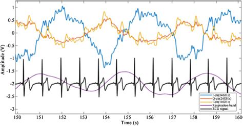 A Sample Of Waveforms Recorded 18 Download Scientific Diagram