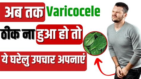 अब तक Varicocele ठीक ना हुआ हो तो ये घरेलु उपचार अपनाएं Varicocele