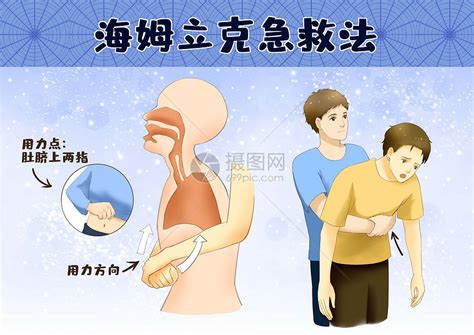 海姆立克急救法插画图片下载 正版图片402011479 摄图网