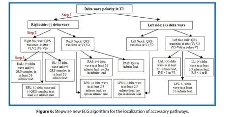 accuracy of the new electrocardiogram algorithm in predicting loc