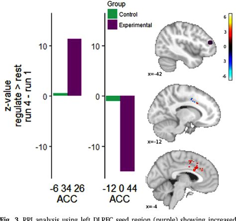 Figure 3 From Using Connectivity Based Real Time Fmri Neurofeedback To