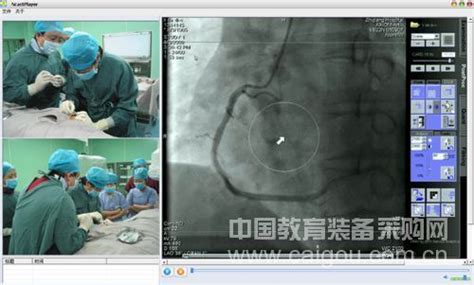 使用录播减少医疗纠纷 术野摄像机 高清会议摄像机 电控云台摄像机 数字中转器 深圳市普智达科技