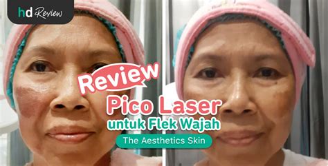 Review Pico Laser Di The Aesthetics Skin Hdmall