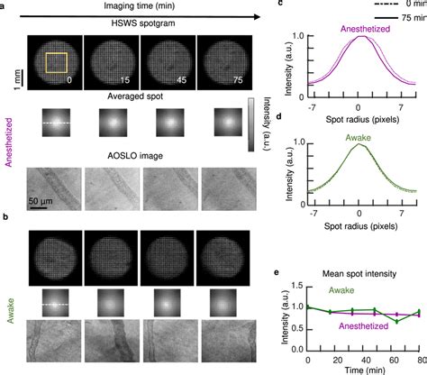 Evaluation Of Ao Wavefront Correction In The Head Restrained Awake Download Scientific Diagram