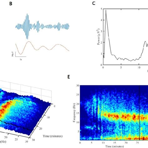 Analysis Process From The Raw Electroencephalogram EEG To The Download Scientific Diagram