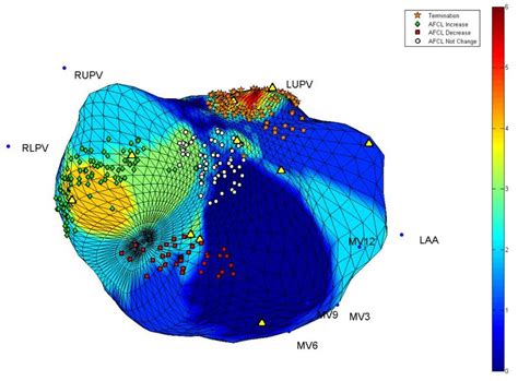 Example La Geometry From Matlab In A Patient Who Terminated During Hdf