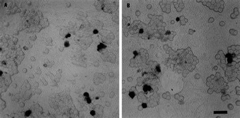 Galactosidase Staining Of Sensory Neurons In Culture At Times After