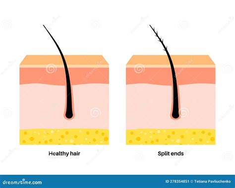 Normal Hair Structure In Scalp Skin Cross Section Icon Cartoon Vector 264957005