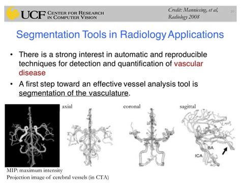 Lec Medical Image Segmentation I Radiology Applications Of Segmentation And Thresholding