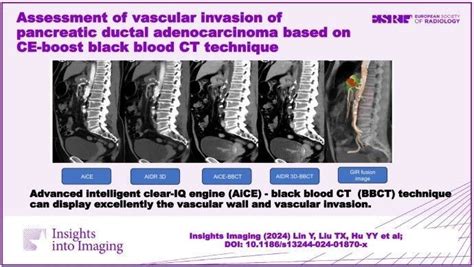 Insights Into Imaging On Linkedin Insightsintoimaging