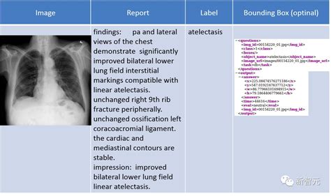 【3万患者11万图像14类病理】nih公开大规模胸部x光数据集