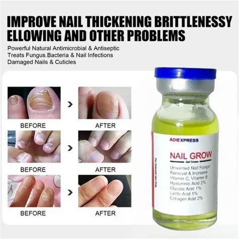 Nail Fungus Cream Nail Fungus Treatment Nail Strengthening Oil