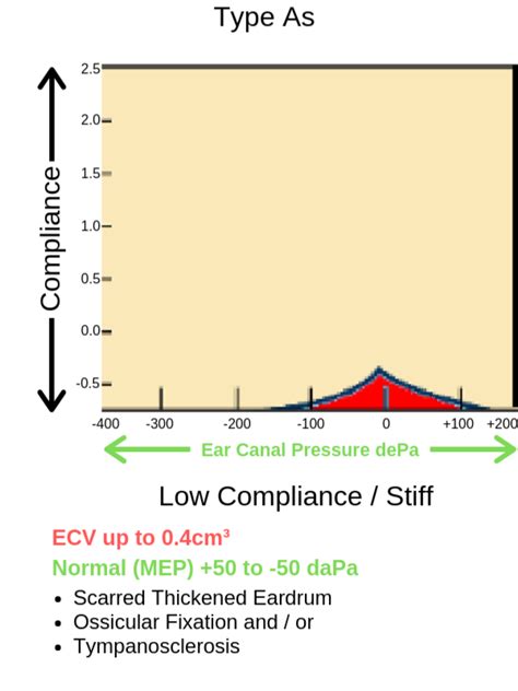 Tympanometry ¦ Middle Ear Test ¦ Hearing Test ¦ Audio Tests