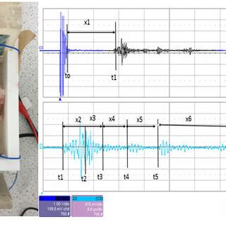 Ultrasound Reflection From Sample MF Download Scientific Diagram