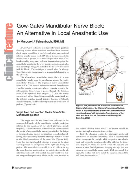 Gow Gates Nerve Block Anesthesia Human Head And Neck