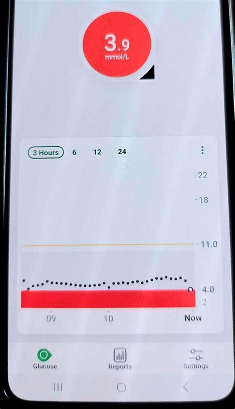 Strange Short Lived Dips In Graph R Dexcom