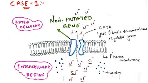 Cystic Fibrosis Types Of Mutations At Megan Cisneros Blog