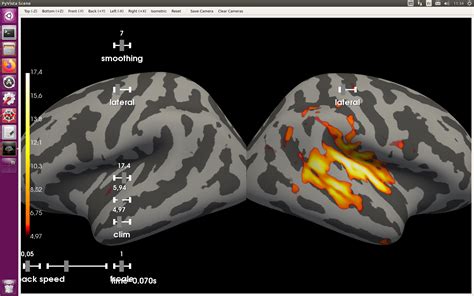 stc plot with pyvista error with hemi both · issue 7250 · mne tools