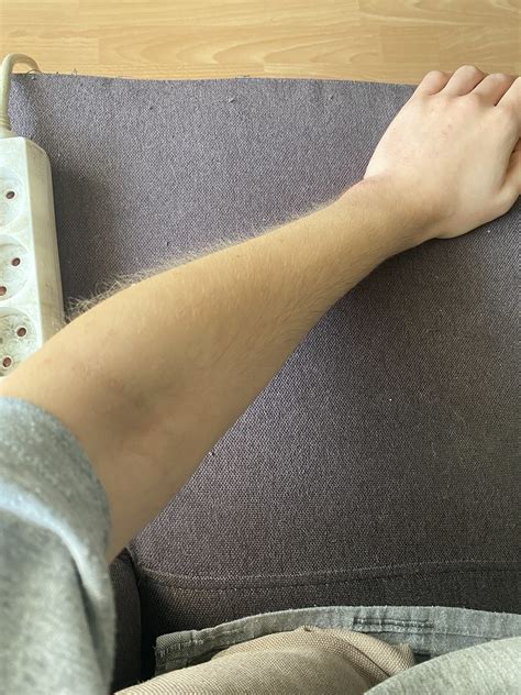 Arm Fuzz Lunaka Luna Ka Flickr