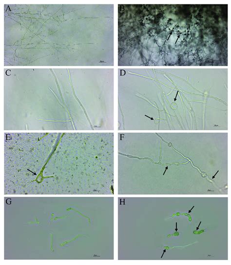 Hyphal And Conidial Morphology Of Ilyonectria Robusta Photographed By